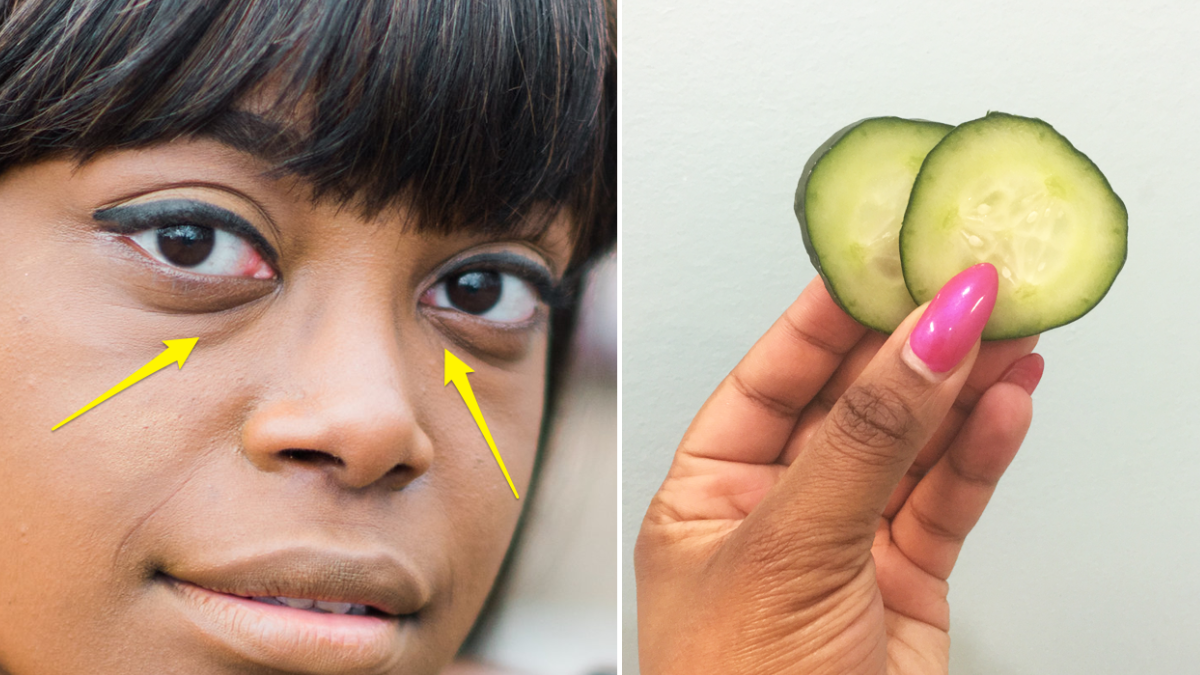 I tried 7 under-eye bag hacks from $0 to $50 for puffiness