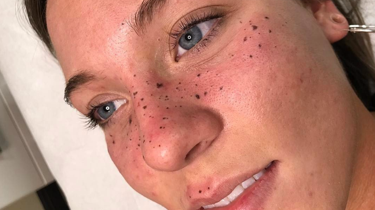 Freckle tattoos are a thing, but they're not that crazy