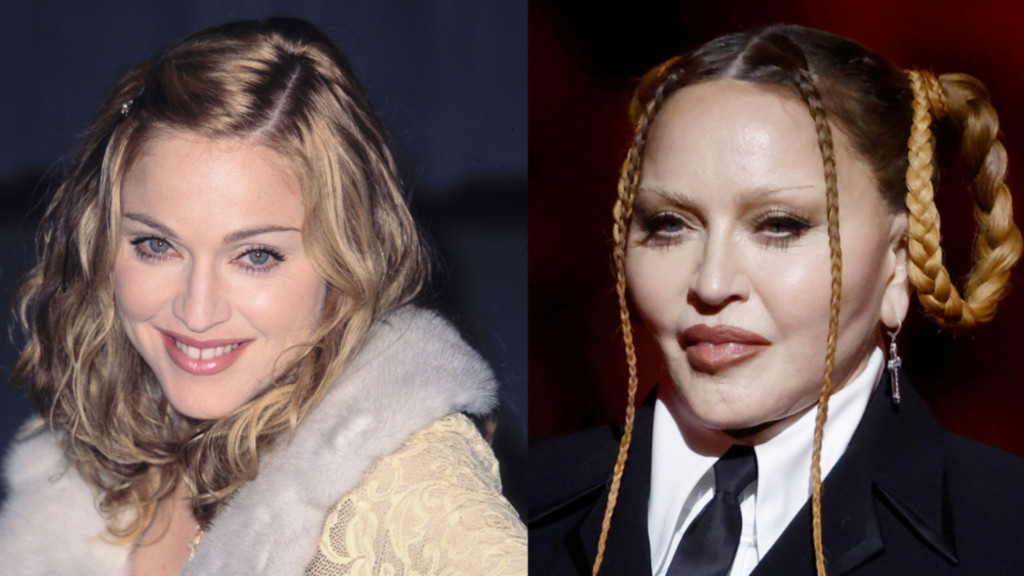 Madonna Seems To Confirm She Had Plastic Surgery Weeks After Grammys ...