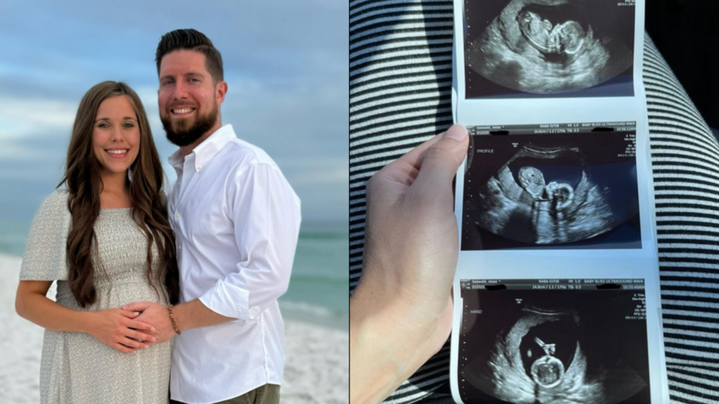 Jessa Duggar Shares Sweet Sonogram Photo of Rainbow Baby After Pregnancy Loss