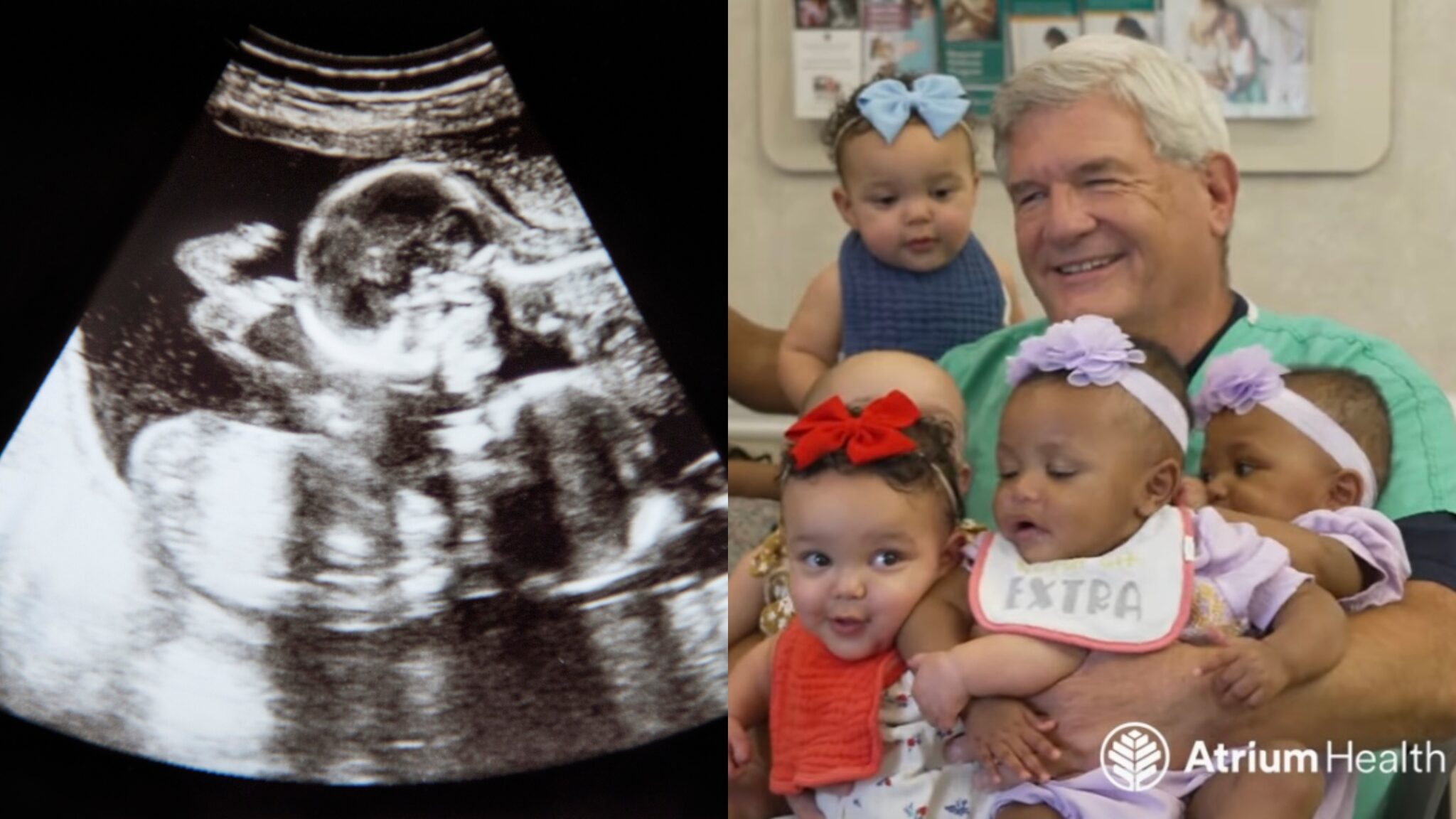 OB-GYN Delivers 3 Sets of Rare Twins Within 3 Months — Will 'Never ...