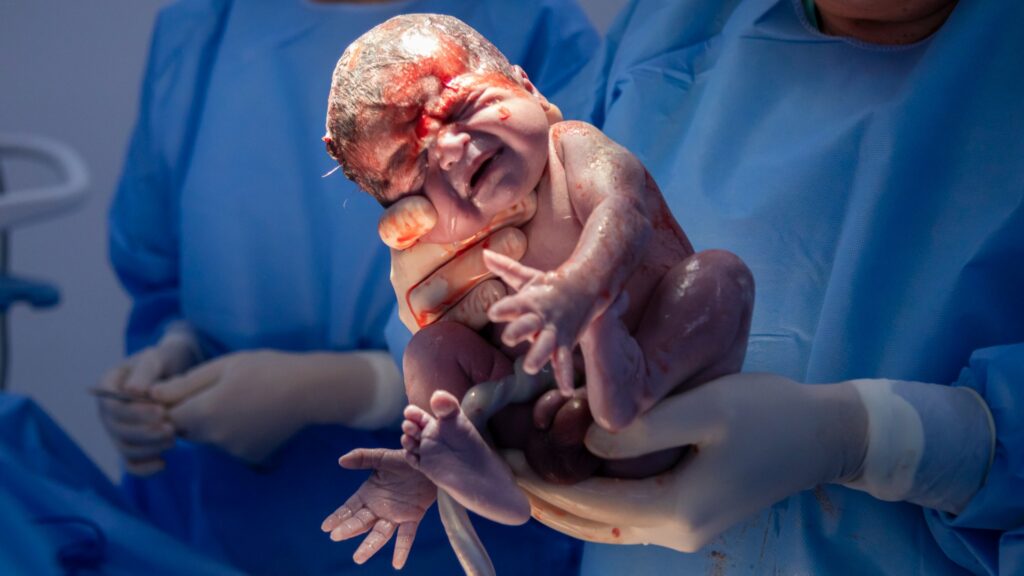 15 Birth Photos That Show How Amazing the Vagina Really Is