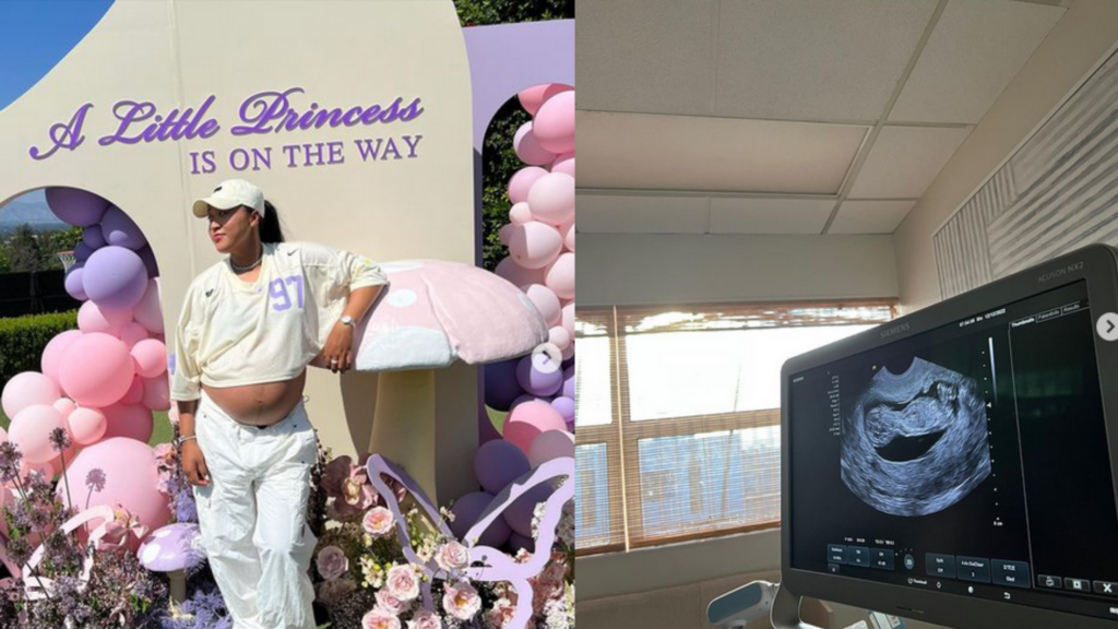 Naomi Osaka Welcomes Her First Child With Rapper Cordae