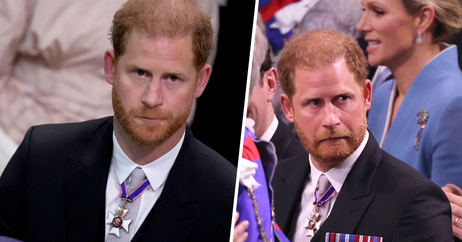 Experts Say Prince Harry's Balding Is Only Getting Worse With Stress ...