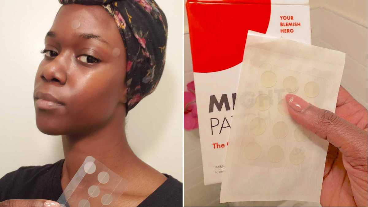 I Reviewed The Mighty Patch, Amazon's Most Popular Acne Patches
