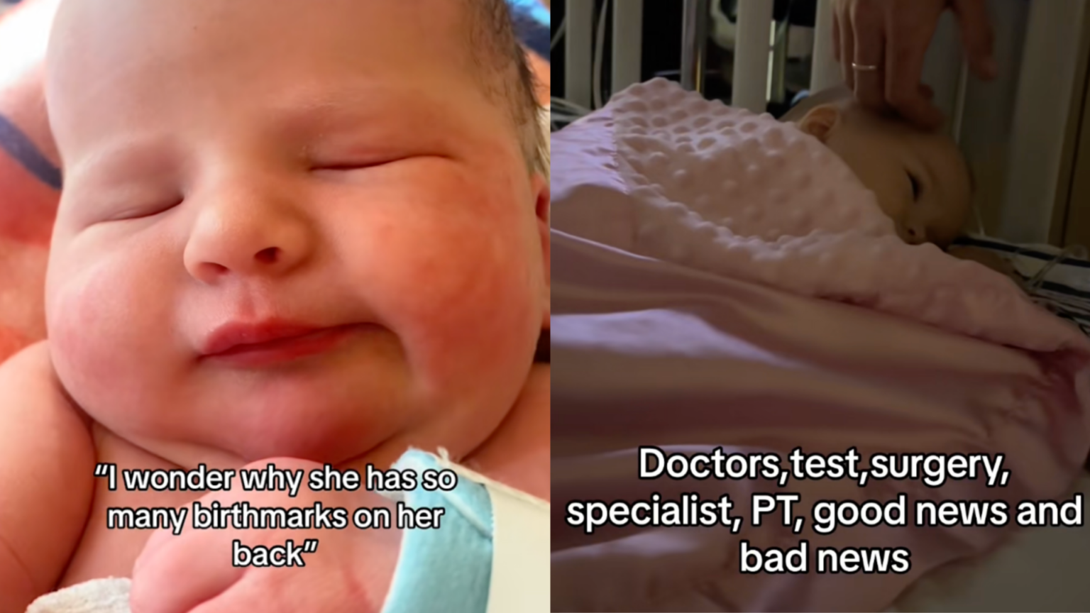Baby's Birthmarks on Her Back Lead to Life-Altering Diagnosis