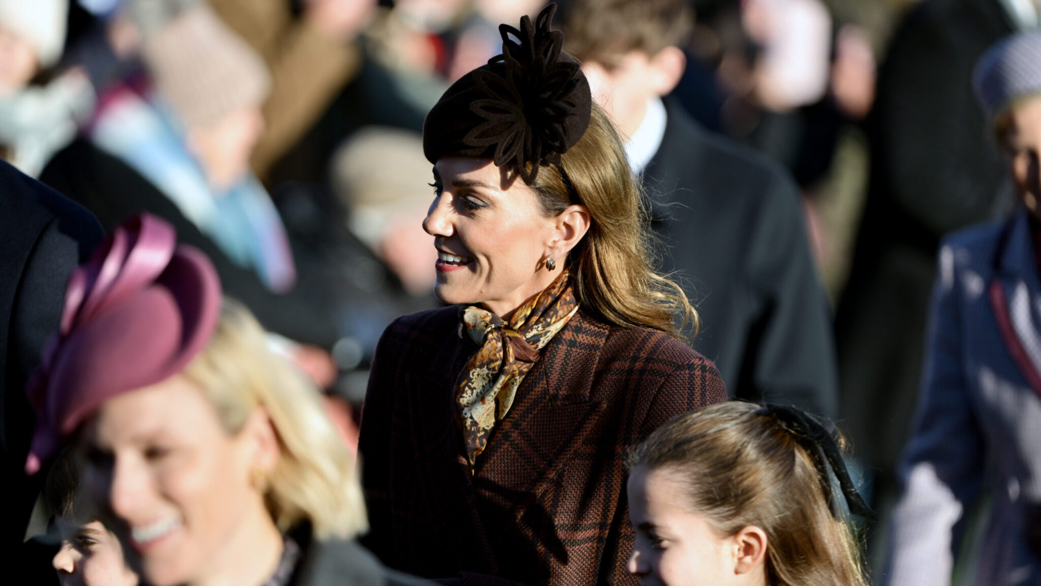 Scar on Kate Middleton's Face Sparks Conspiracy Theories